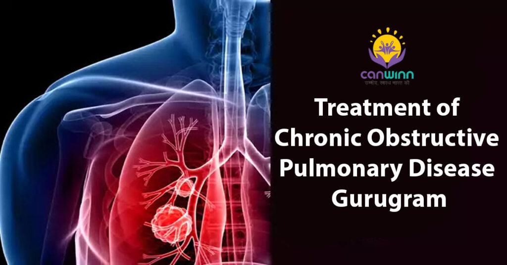 Treatment of Chronic Obstructive Pulmonary Disease Gurugram - CanWinn ...